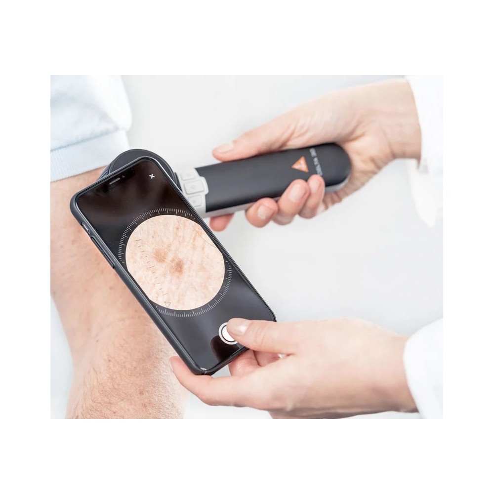 HEINE DELTA 30 Dermatoscope set in case